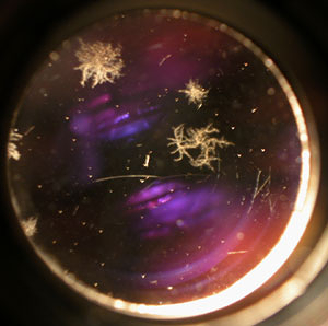 All about lens fungus | TLRgraphy